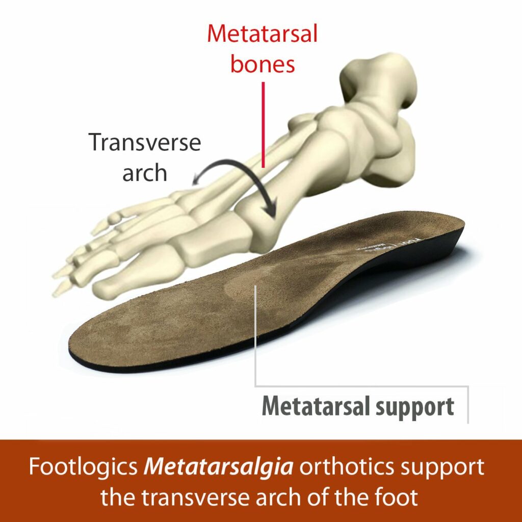 Footlogics Meta Full-length | Footlogics Orthotics